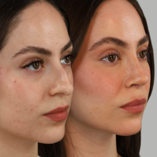 Dr. Ashkan Ghavami Beverly Hills & Los Angeles, CA | Ghavami Plastic ...